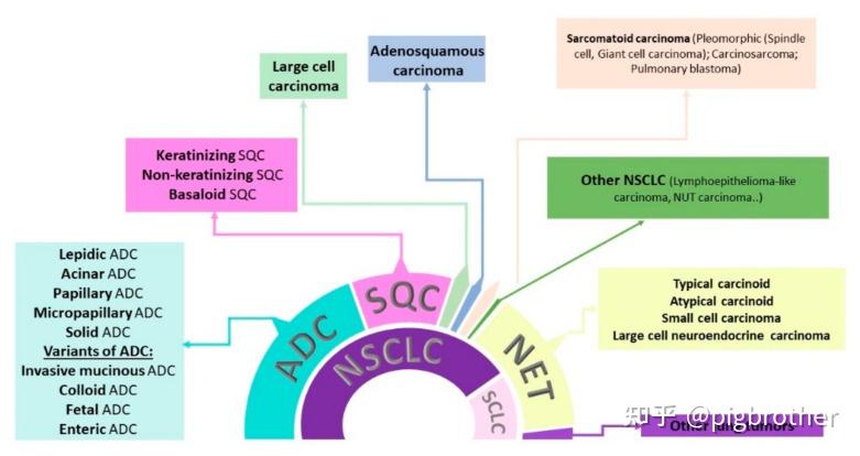 非小细胞肺癌 （NSCLC） 管理中的诊断、预测和预后生物标志物 - 知乎