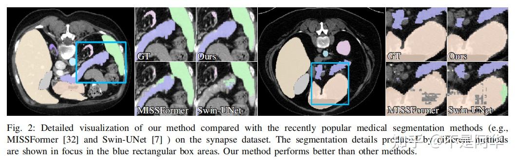MSCAAttention，一种多尺度跨轴注意力机制及其代码实现 - 知乎