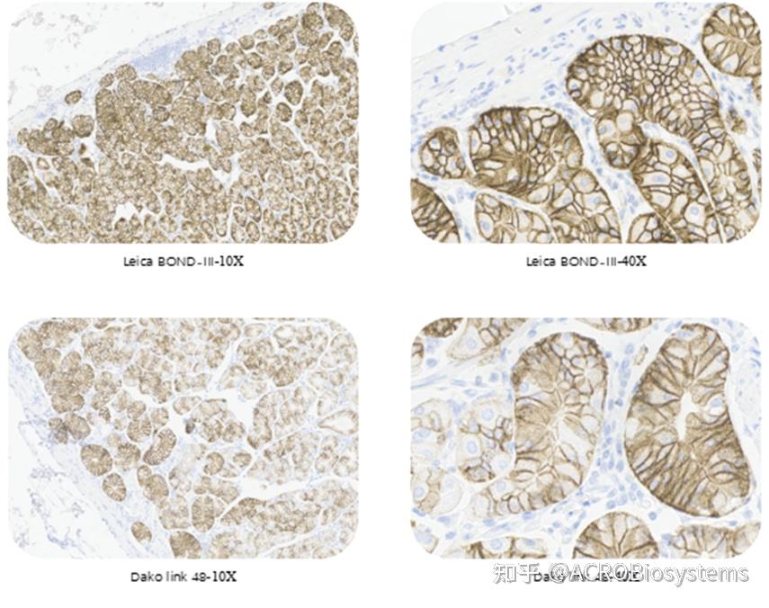 【IHC精准检测】——筛选获益人群关键抗体：Claudin 18.2 - 知乎