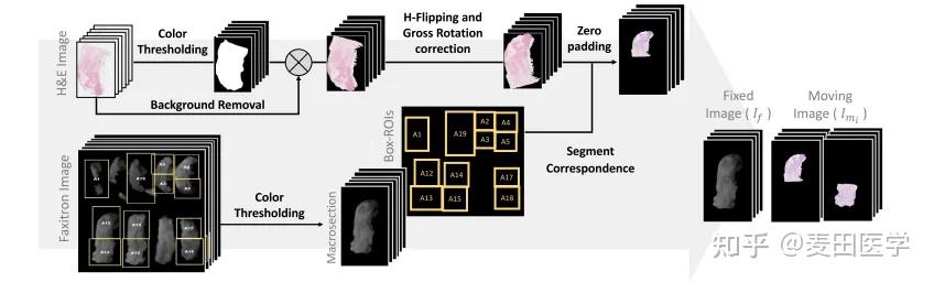 PViT-AIR：基于视觉转换器的乳腺组织多组学和Faxitron图像仿射配准|文献速递-生成式模型与transformer在医学影像中的应用 ...