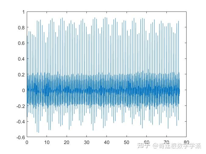 基于深度学习的心电信号（ECG）识别（MATLAB R2021B） - 知乎