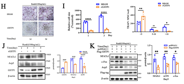 GSTP1介导的Pik3r1的S-谷胱甘肽化调控破骨细胞形成 - 知乎