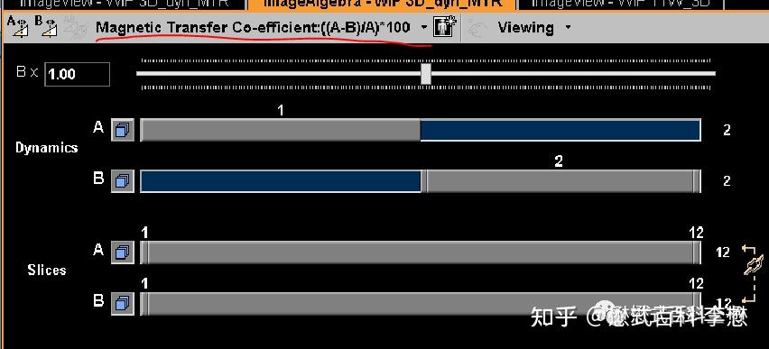 3D dyn MTR序列及临床应用 - 知乎