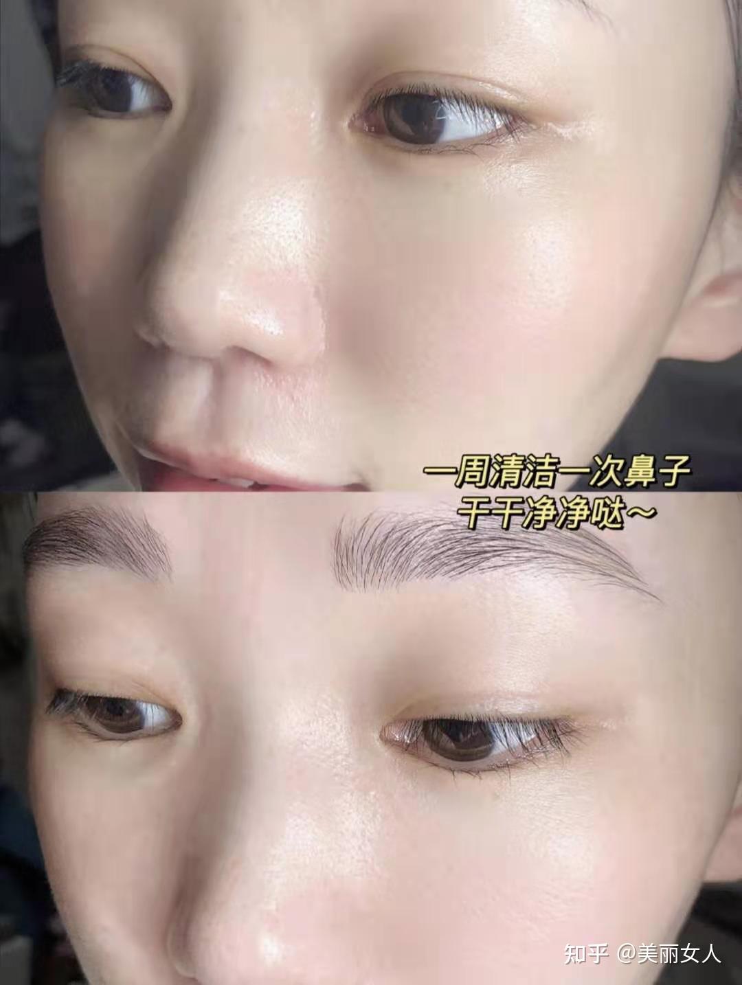 去黑头收缩毛孔的最好方法 知乎