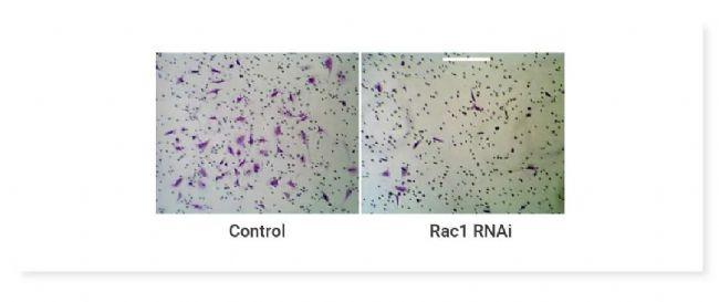 细胞迁移 VS 侵袭大不同！想要划痕和 Transwell 实验的实操？包会的！ | MedChemExpress (MCE) - 知乎