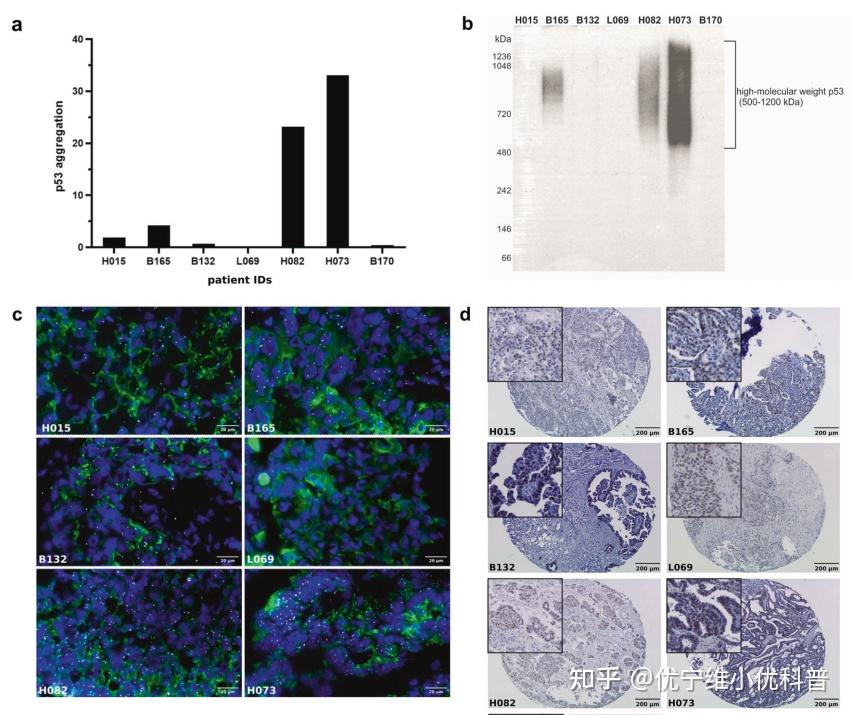 小优读文献∣Naveni® PLA技术&现有文献部分解析 - 知乎