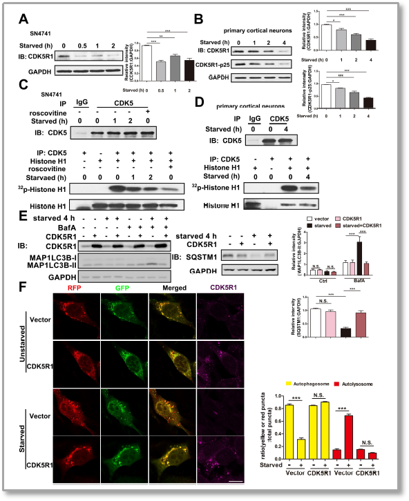 Autophagy︱杨倩课题组揭示转录因子TFEB入核调控新机制 - 知乎