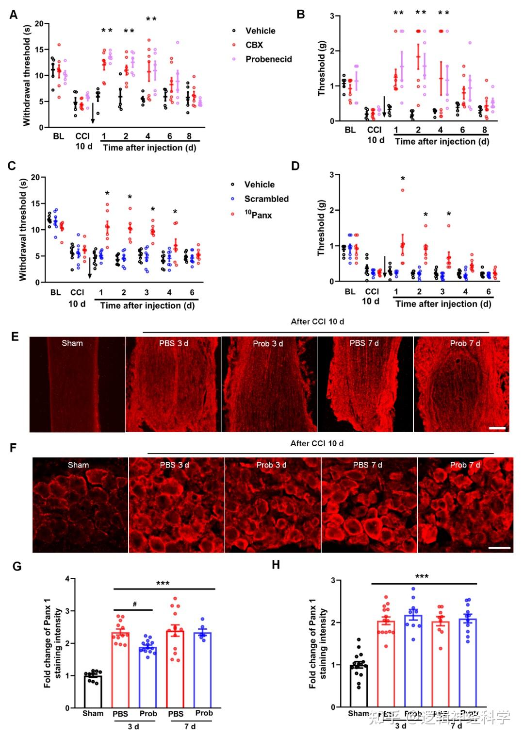 J Neuroinflammation︱南通大学陈罡课题组揭示施万细胞Pannexin 1通过介导炎症反应调节神经病理性疼痛 - 知乎