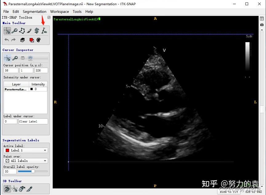 [图像分割]ITK-SNAP分割标注（点坐标） - 知乎