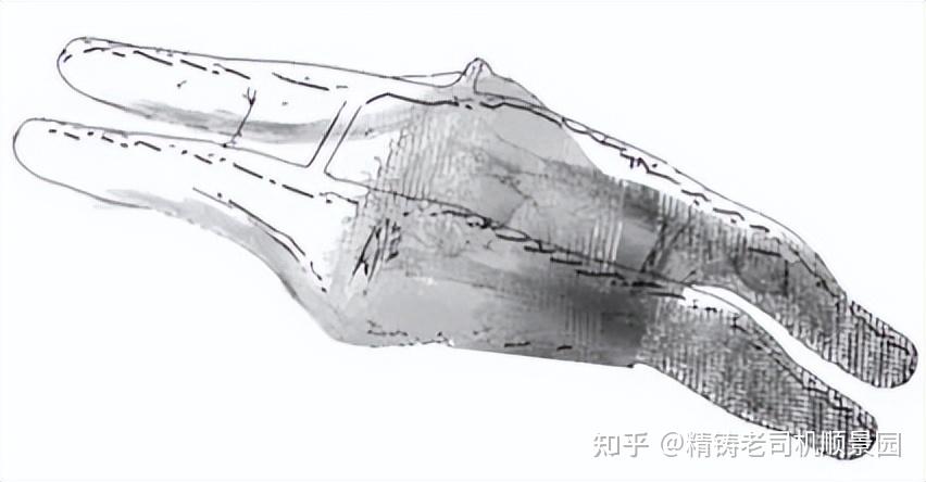 铝合金差压铸造下摆臂产品屈服强度240MPa以上，伸长率平均10% - 知乎