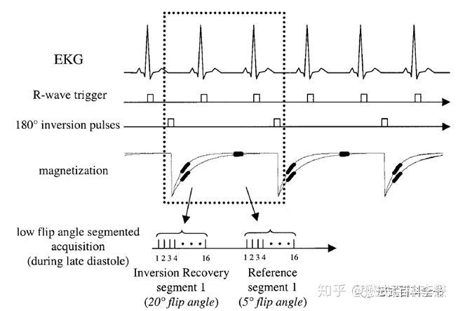 心脏磁共振技术大全（六） - 知乎