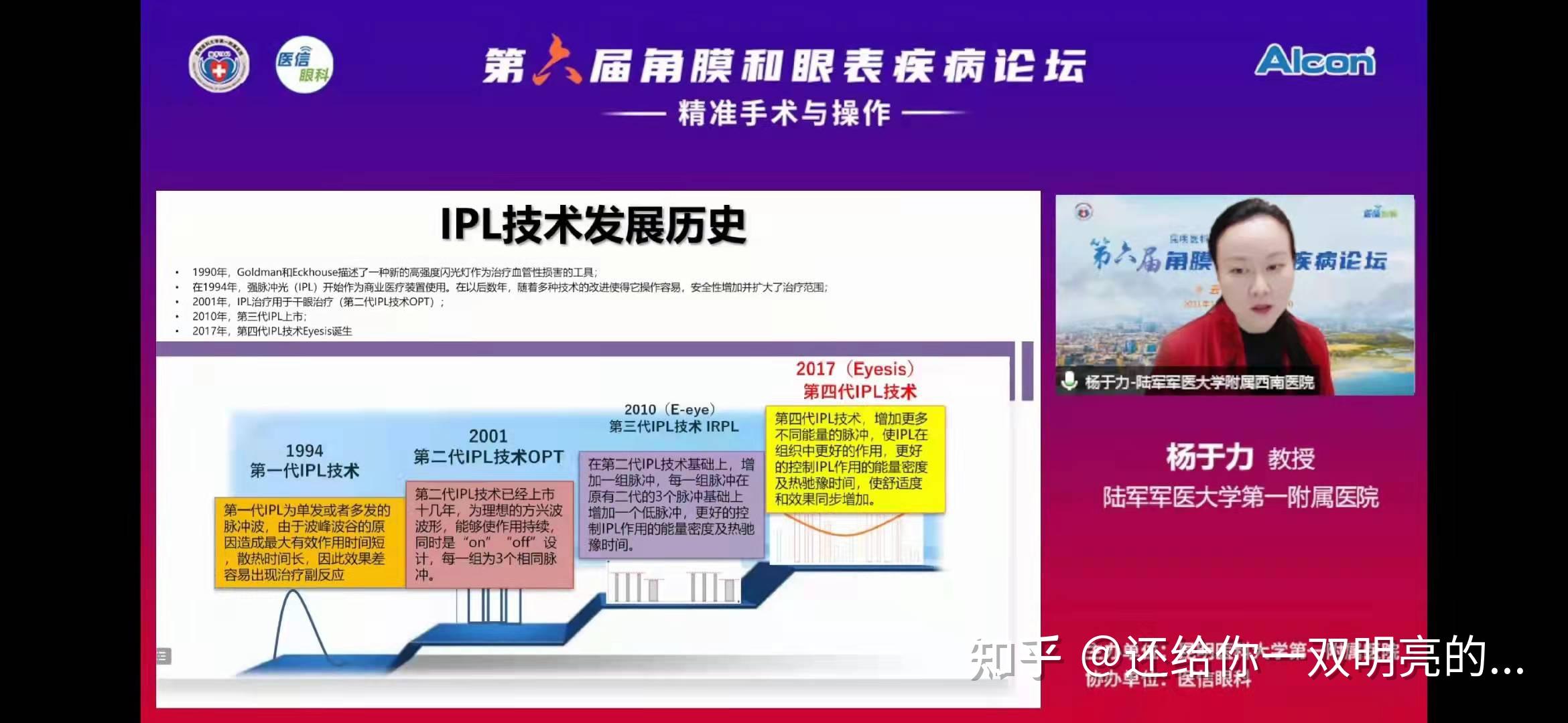 专家讲解强脉冲光（IPL）治疗干眼的临床应用 - 知乎