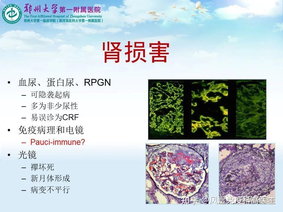 2022年ANCA相关血管炎诊疗进展 - 知乎