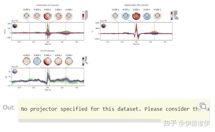 preprocessing——artifact detection - 知乎