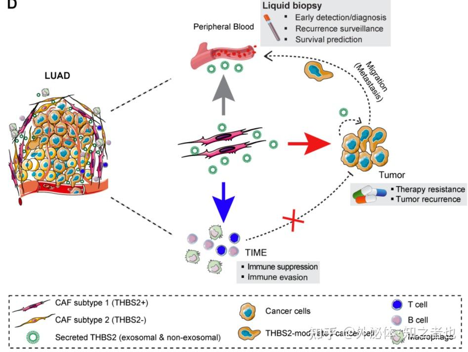 项目文章：组织外泌体助力解析TME明星分子THBS2促进早期肺腺癌侵袭转移机制 - 知乎
