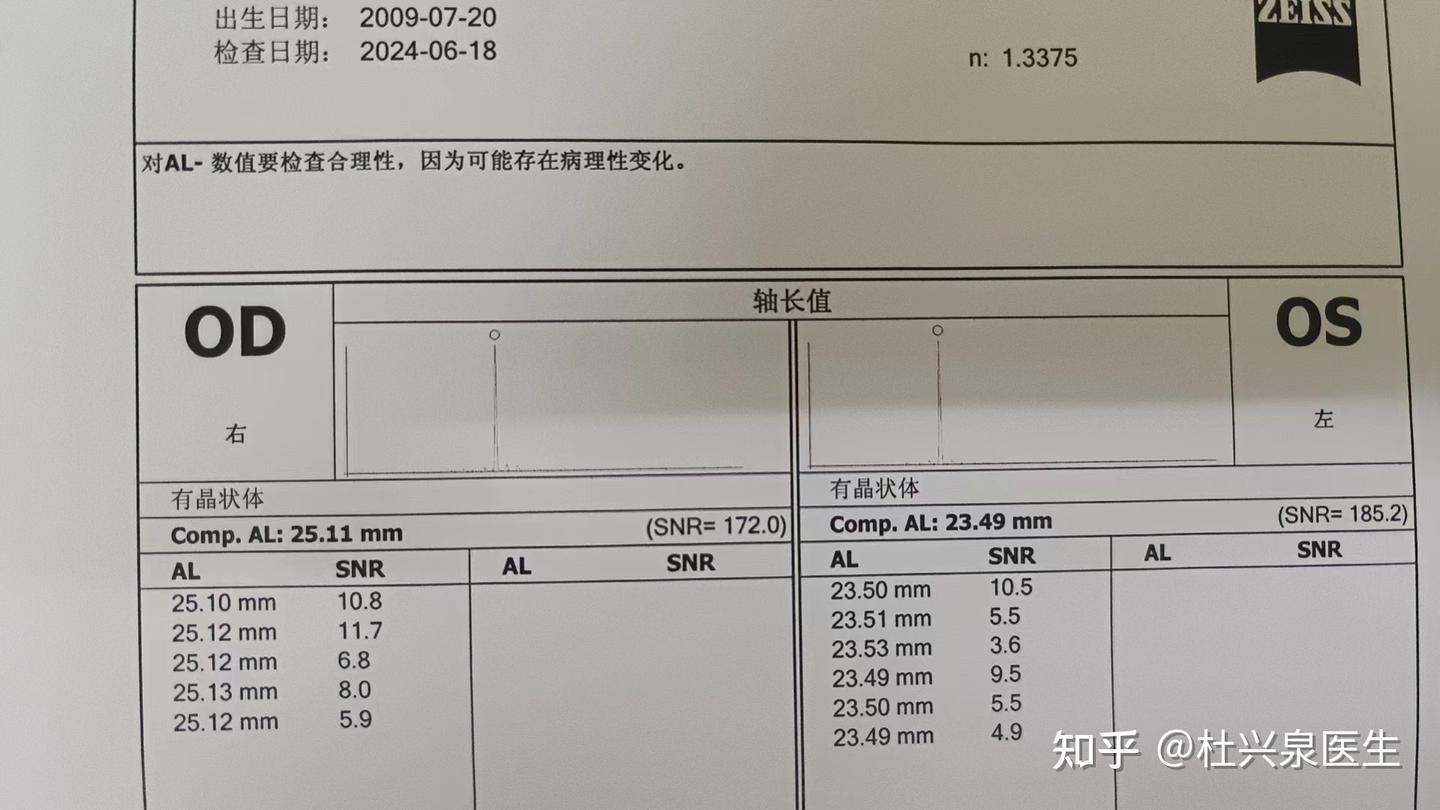 相对负调节NRA和相对正调节PRA，这样测更有意义 - 知乎