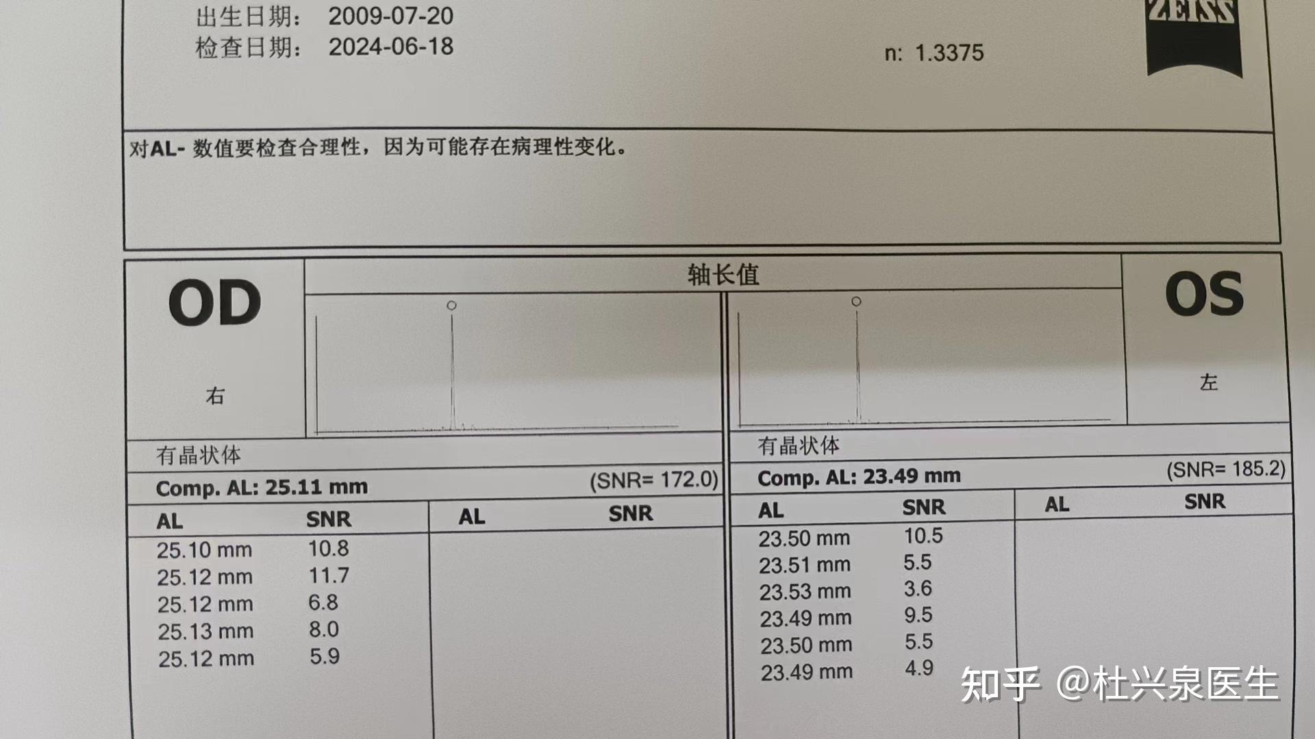 相对负调节NRA和相对正调节PRA，这样测更有意义 - 知乎