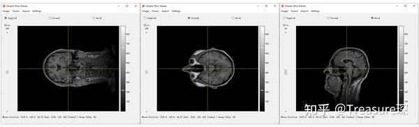 Python科研图像处理——Slice Viewer - 知乎