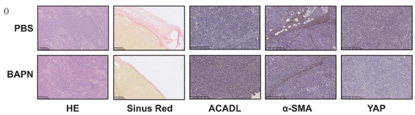 Q1区10分+单细胞联合bulk RNA！聚焦热点方向“代谢”，打造生信分析文章新高度！ - 知乎