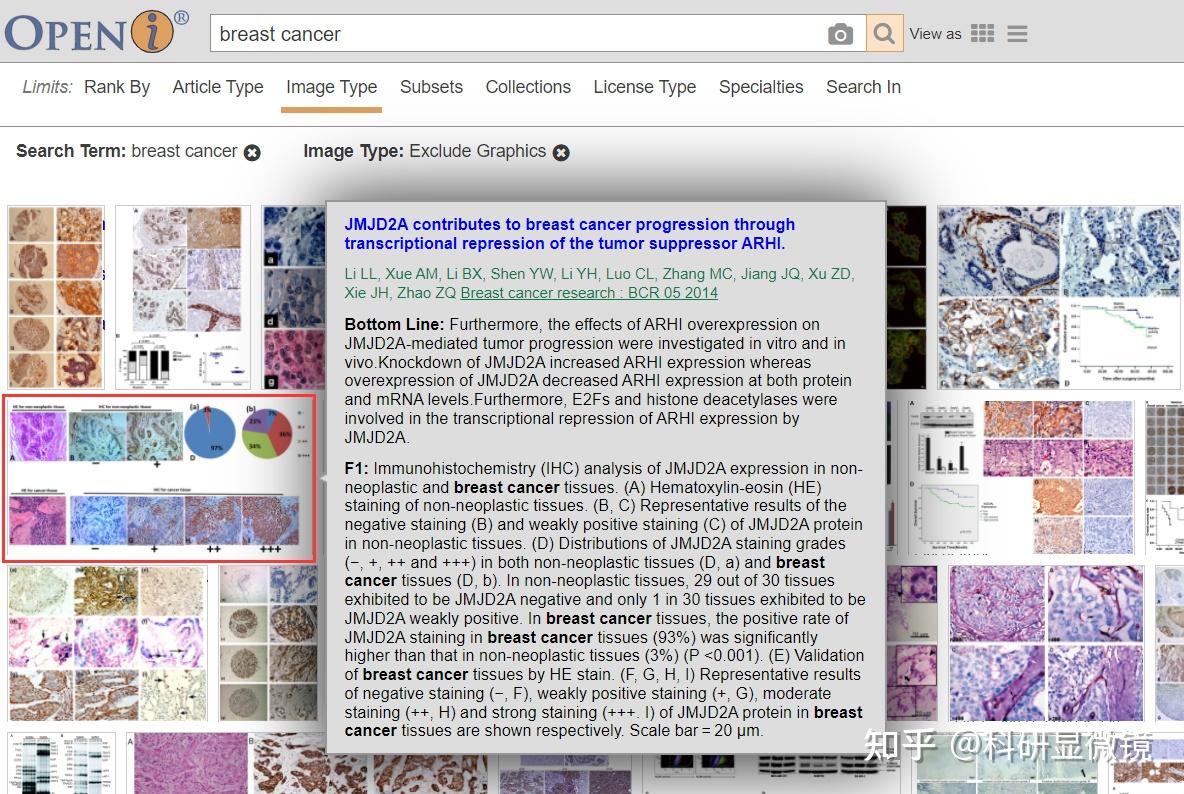SCI写作-利用NCBI下的网页OPENI进行图片检索，制作高大上的流程图，反向检索文献 - 知乎