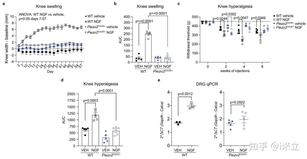IF:17.694|Piezo2：一个治疗骨关节炎疼痛的新靶点 - 知乎