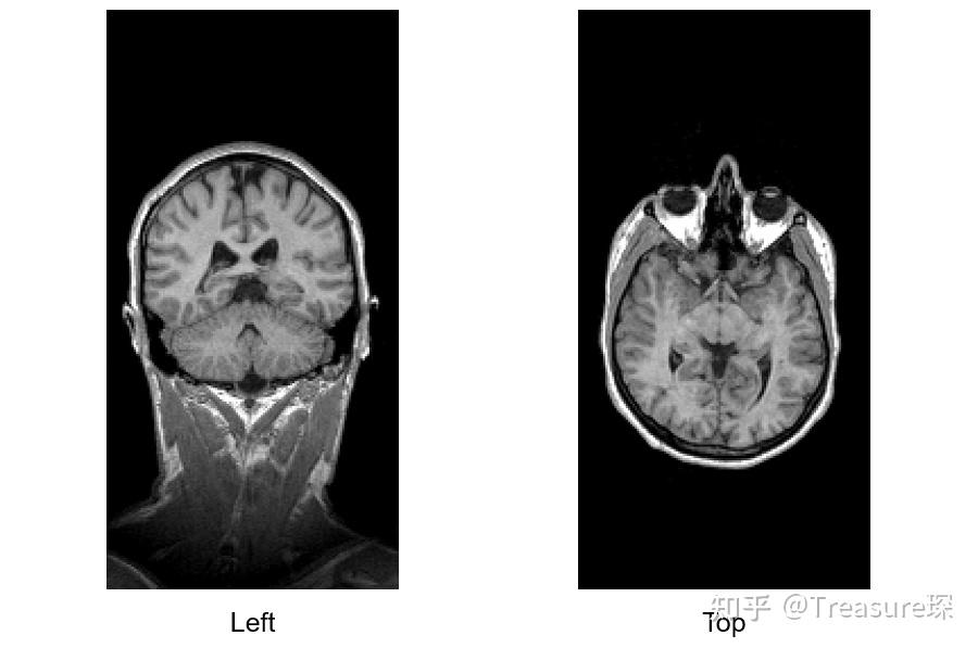 ImageJ实用教程——3D Stack Reslice(基本功能篇) - 知乎