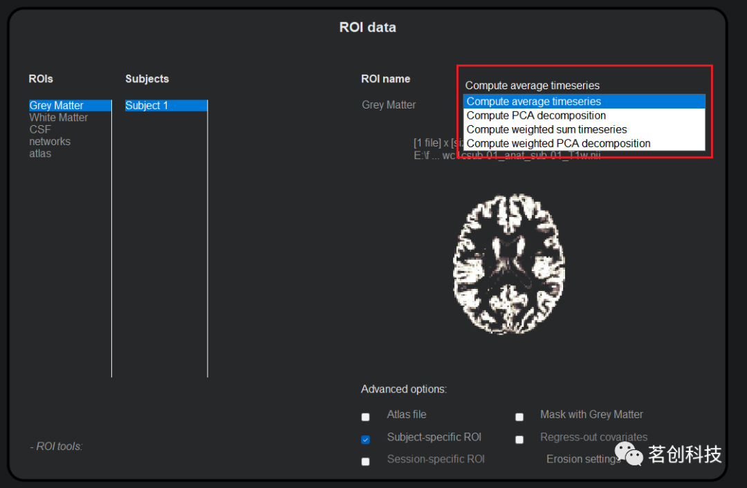 手把手教你使用CONN（预处理） - 知乎