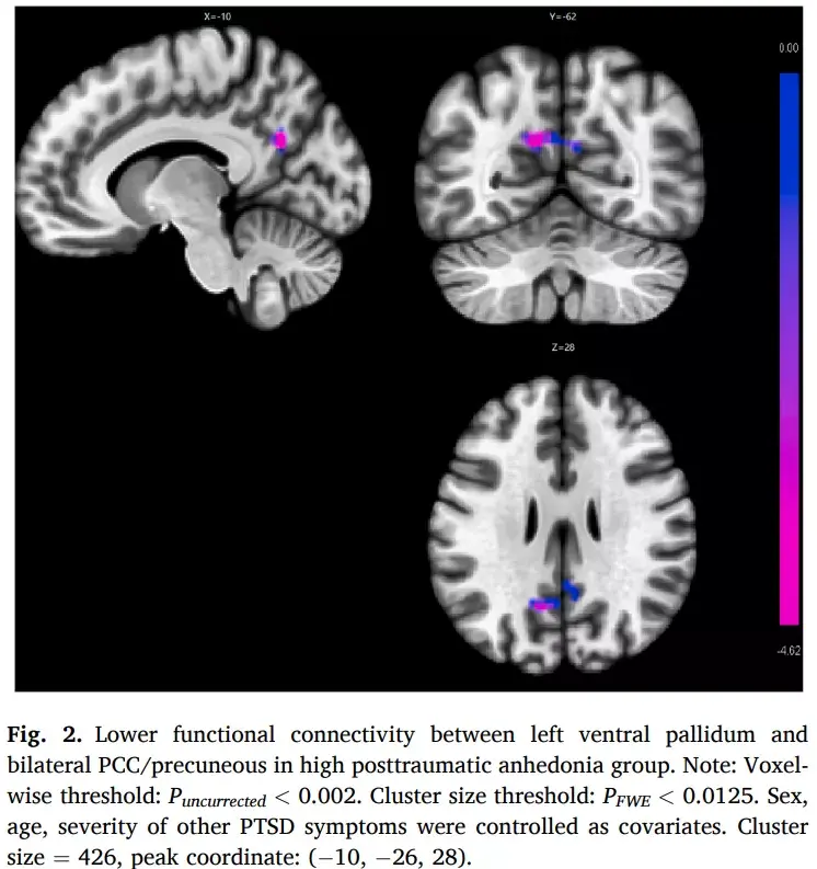 9.11 脑科学日报| Sci Adv：DNMT1突变导致神经退行性疾病分子机制 - 知乎