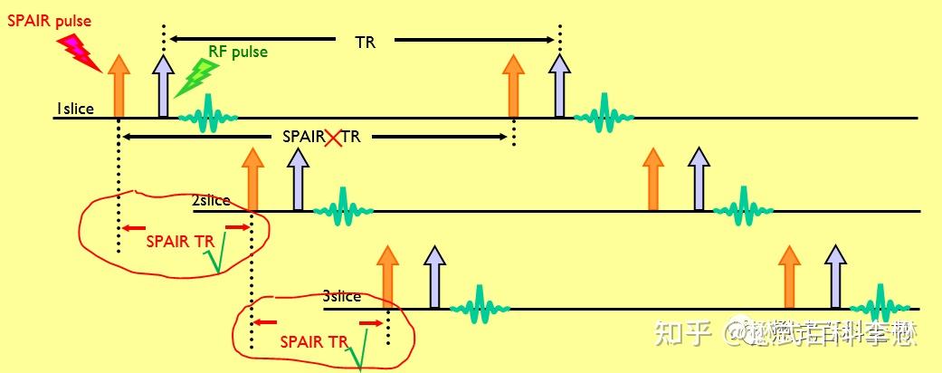 SPAIR序列的TR及TI设置 - 知乎