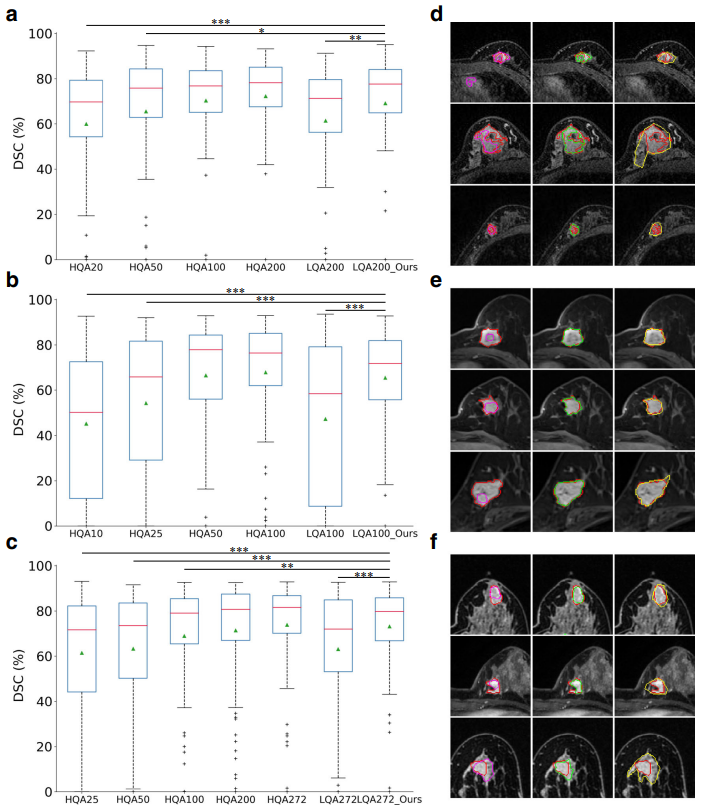 Nat. Commun. | AIDE：用于医学图像自动分割的标注高效深度学习模型 - 知乎