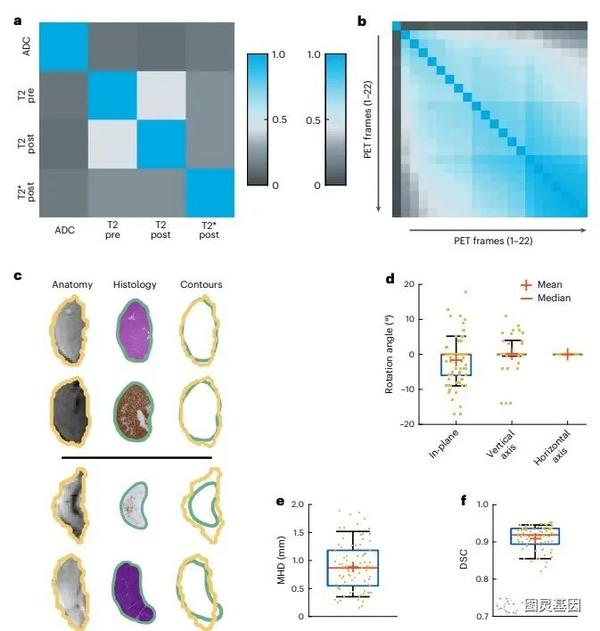 Nat Bio Eng | 德国专家完美匹配PET,MRI与病理图像，检测肿瘤异质性并提高治疗敏感性 - 知乎