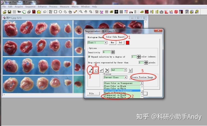 TTC染色详细计算分析过程，步骤详解（组图） - 知乎