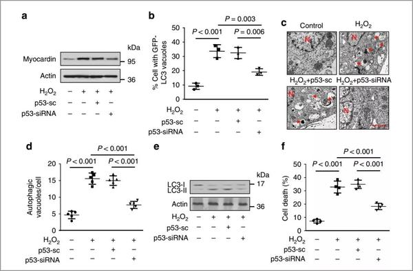 LncRNA＋自噬＋p53＝10分文章 - 知乎