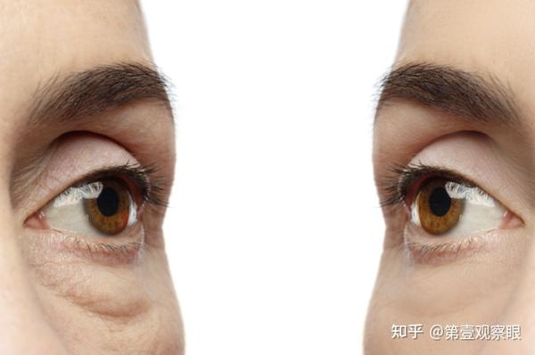 世界首创，抗衰老里程碑IEONA的GeneAKG® - 知乎