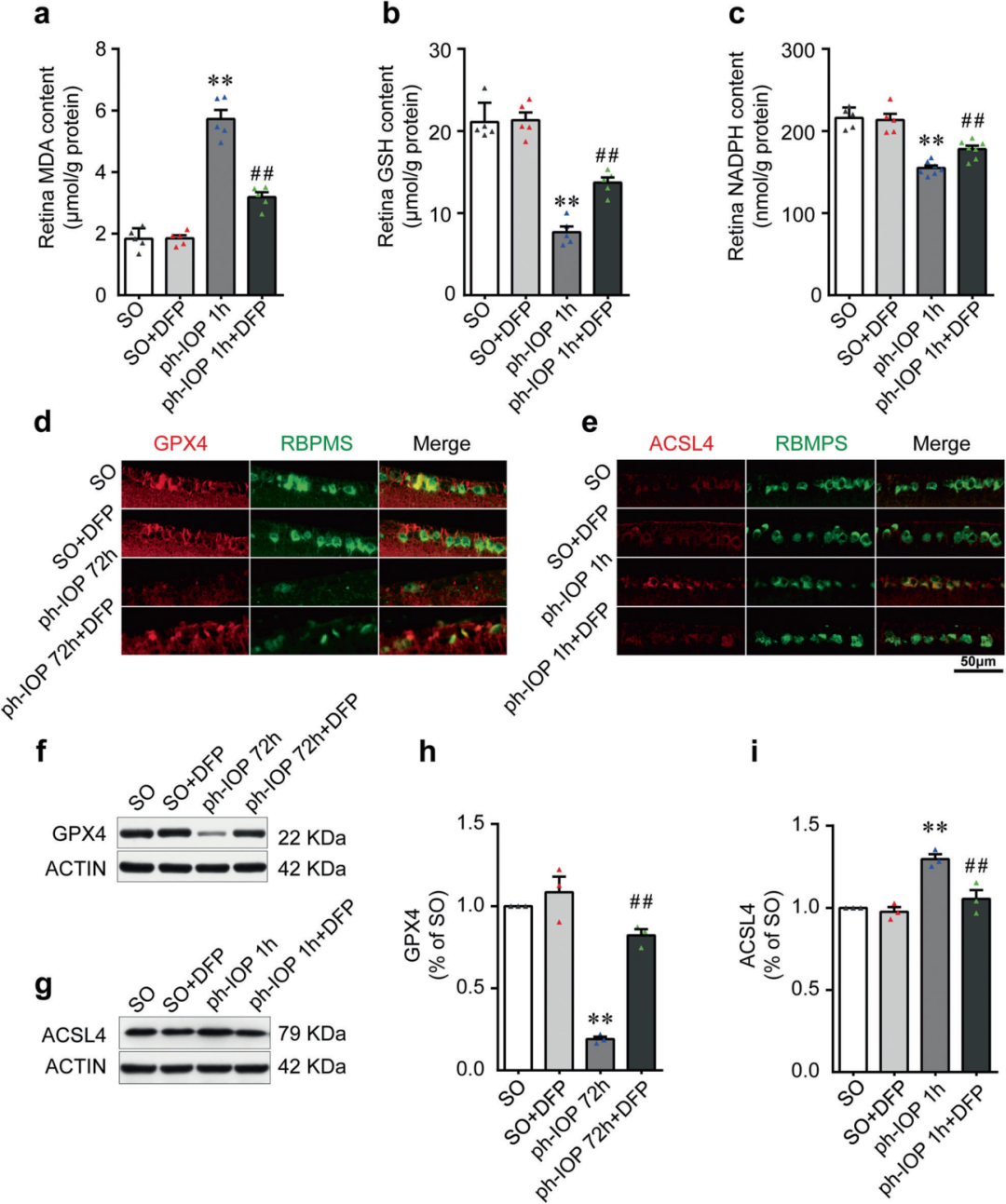 Cell Death Differ︱夏晓波团队首次揭示“铁死亡”与青光眼发病机制之间的相互关系 - 知乎