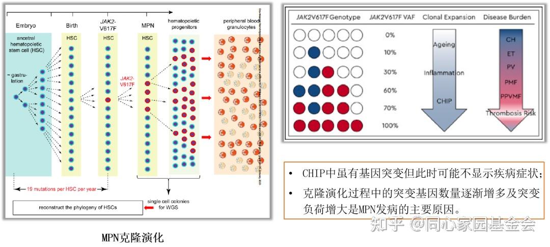 经典型MPN：PV/ET/PMF （1） - 知乎