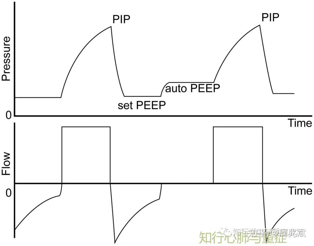 第142期 呼吸力学-从基础到临床 - 知乎