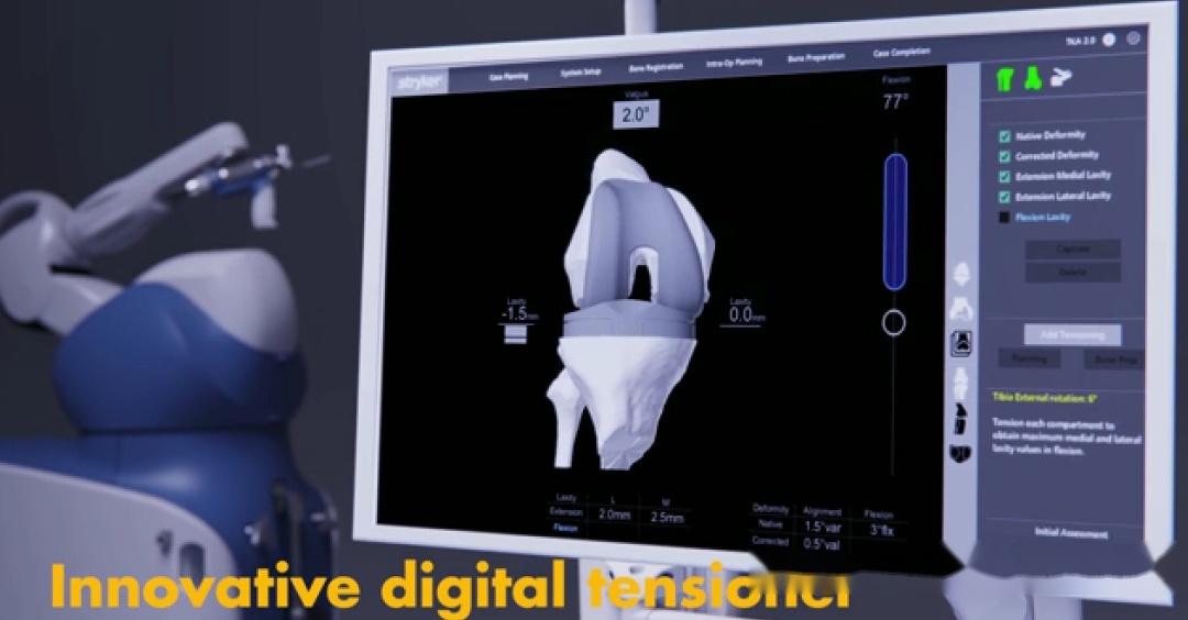 扩大应用！史赛克Mako机器人推出新功能 - 知乎