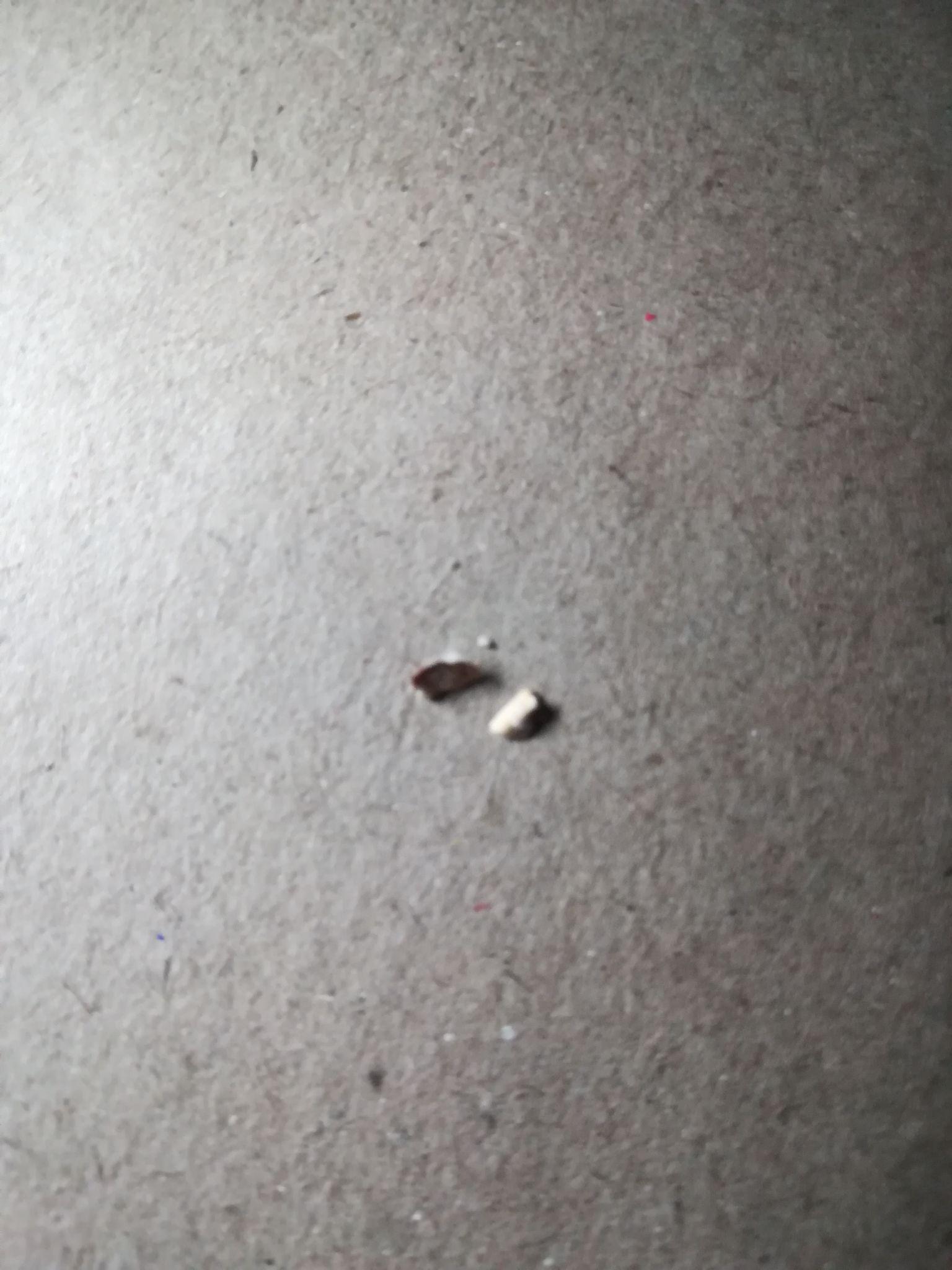 自己扣掉了牙结石是种什么体验。。。 知乎