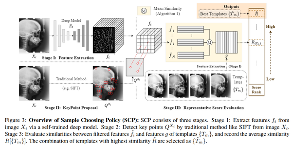 【医学图像-小样本学习】Which images to label for few-shot medical landmark ...