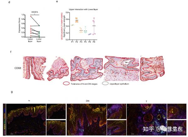 从生信的视角揭示癌症的前世今生 — 癌前病变篇 - 知乎