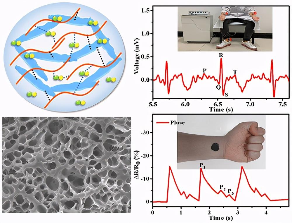 北京化工大学万鹏博《ACS Nano》可修复，降解和导电MXene/PAA水凝胶表皮传感器 - 知乎
