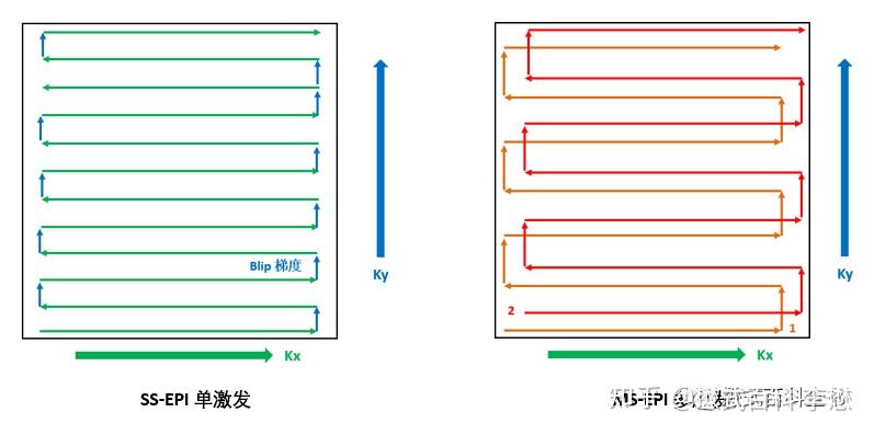 IRIS：多激发SE-EPI扩散（弥散）序列 - 知乎