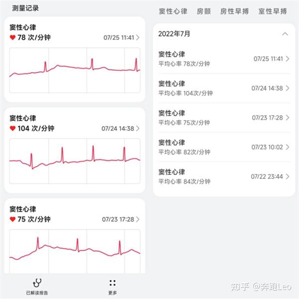 华为WATCH 3 Pro new评测：30秒生成ECG心电采集报告 - 知乎