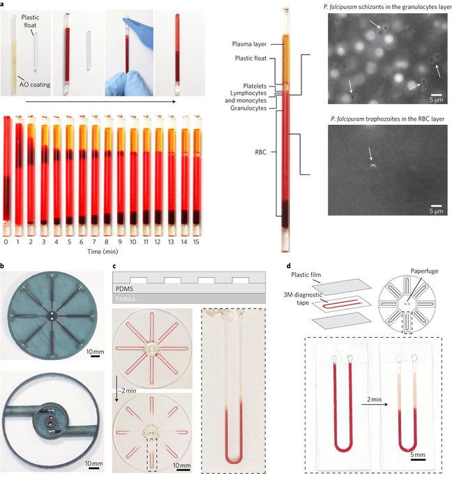惊动整个医疗界的Paperfuge（纸质离心机）,材料就值20美分 - 知乎