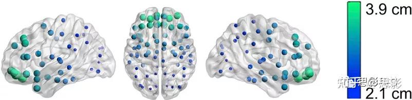 比较脑磁图与高密度脑电图的内在功能连通性 - 知乎