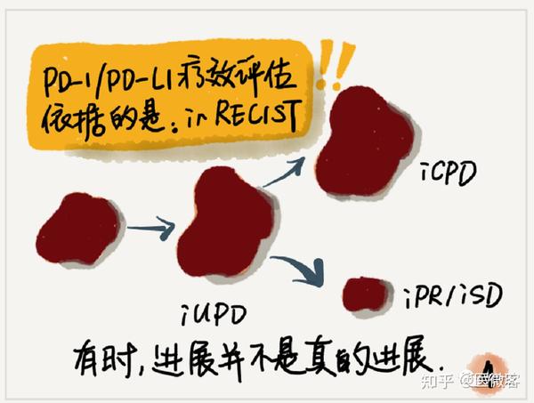 浅谈肿瘤疗效评价的新标准---irRC、iRECIST、ImRECIST - 知乎