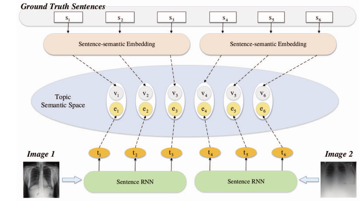 [论文笔记]Automatic Generation of Medical Imaging Diagnostic Report with ...