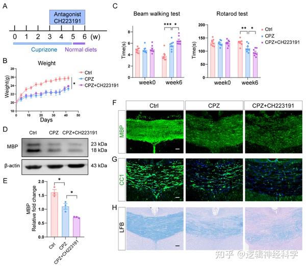 J Neuroinflammation｜复旦大学汪军/王彦青团队揭示小胶质细胞AhR受体调控吞噬作用改善脱髓鞘损伤中的机制 - 知乎