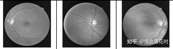 各类滤波器总结（低通、高通、高增强、同态、带通） - 知乎